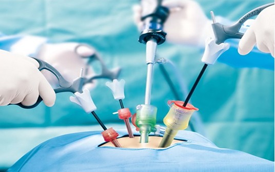 Urologia Zapopan - Nefrectomía Radical